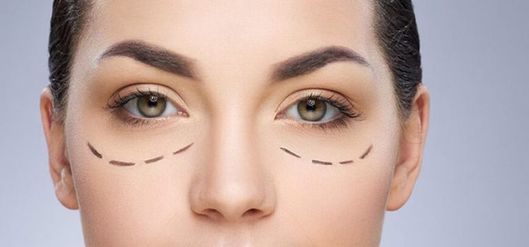 Blefaroplastika - Ent Clinic